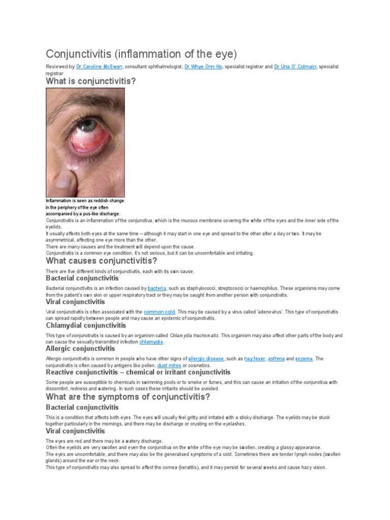 Conjunctivitis (Inflammation of The Eye) | PDF | Clinical Medicine ...