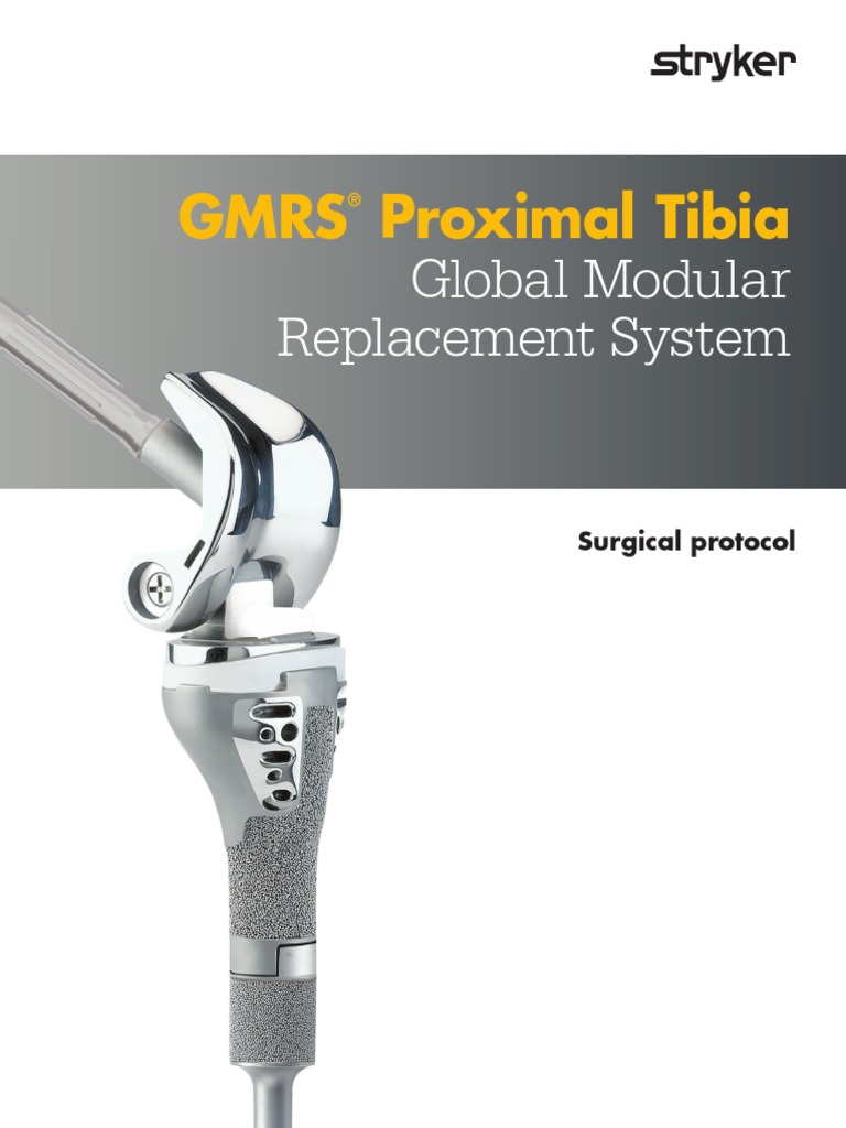 Gmrs Proximal Tibia: Global Modular Replacement System | PDF | Knee ...