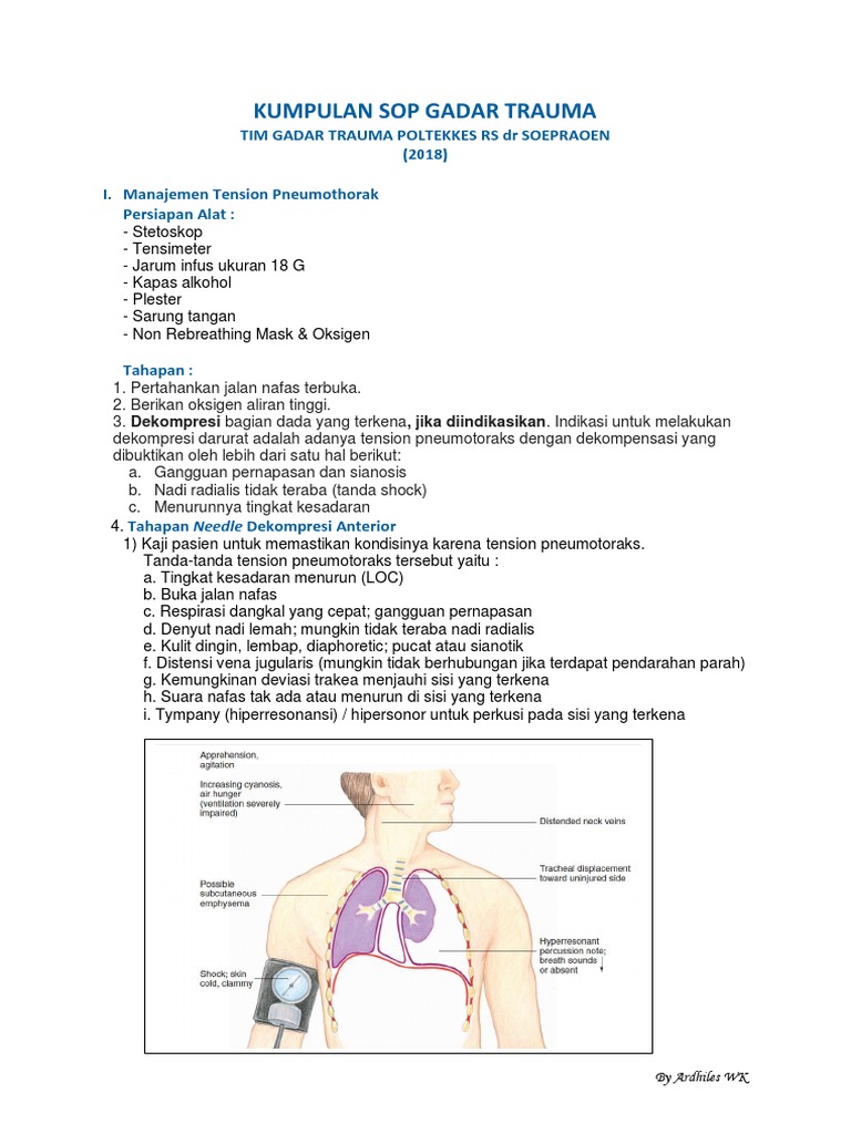 Kumpulan Sop Gadar Trauma | PDF