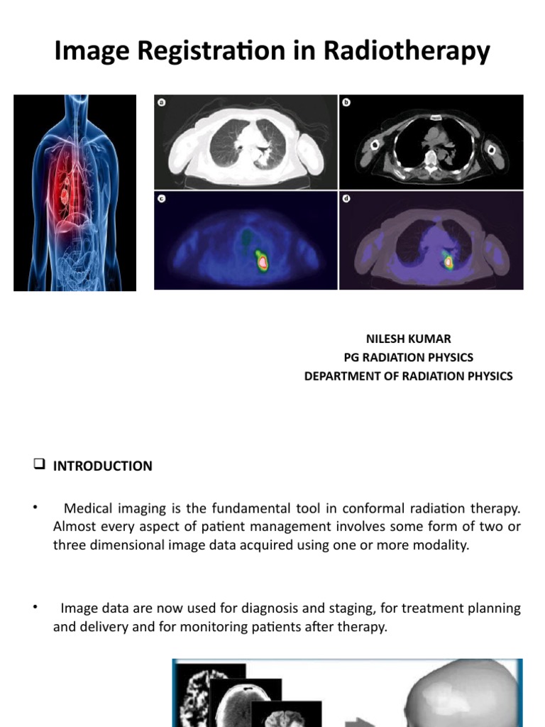 Image Registration in Radiotherapy Techniques | PDF | Medical Imaging ...