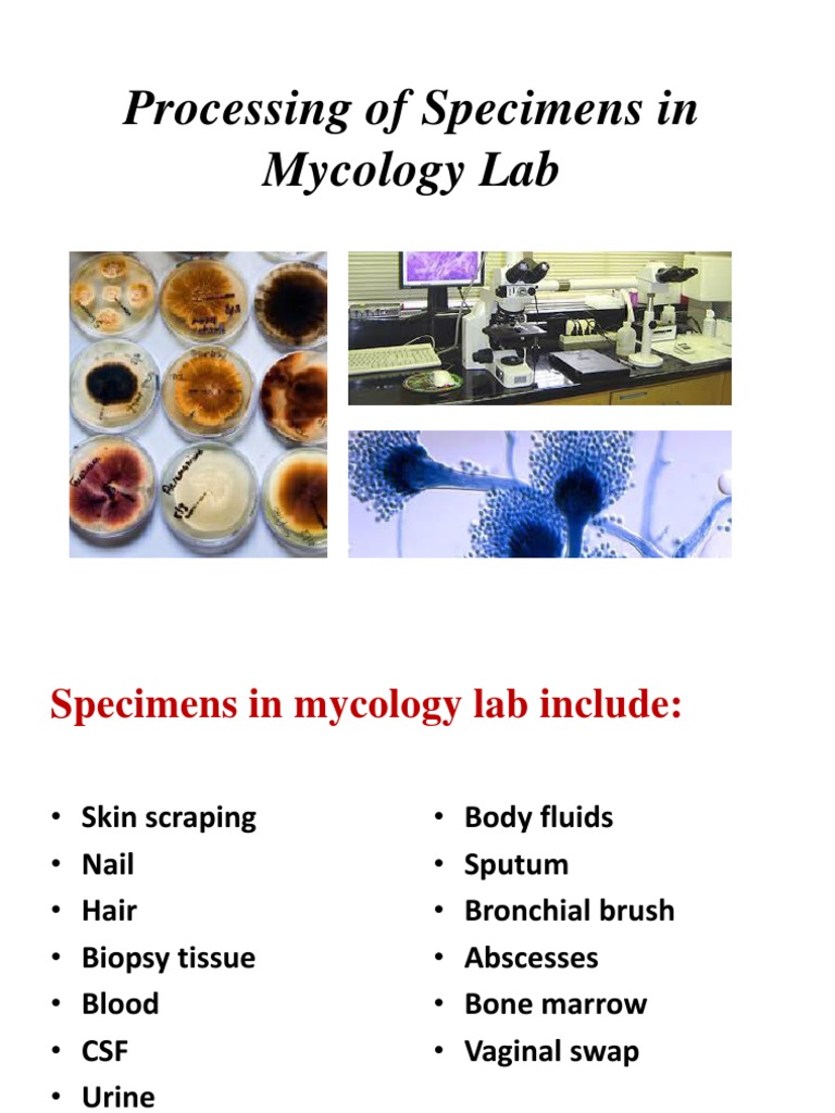 Processing of Specimens in Mycology Lab | PDF | Staining | Laboratory ...