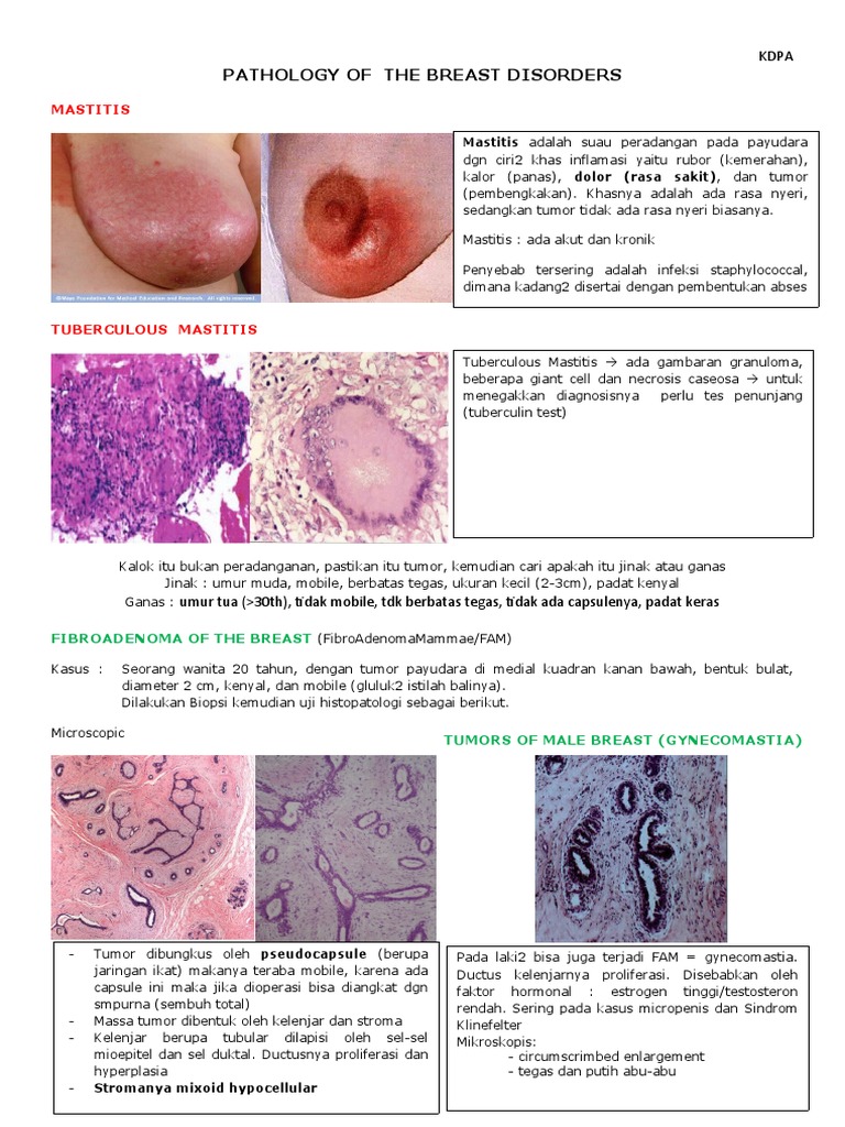 14b. PATHOLOGY OF THE BREAST DISORDERS | PDF