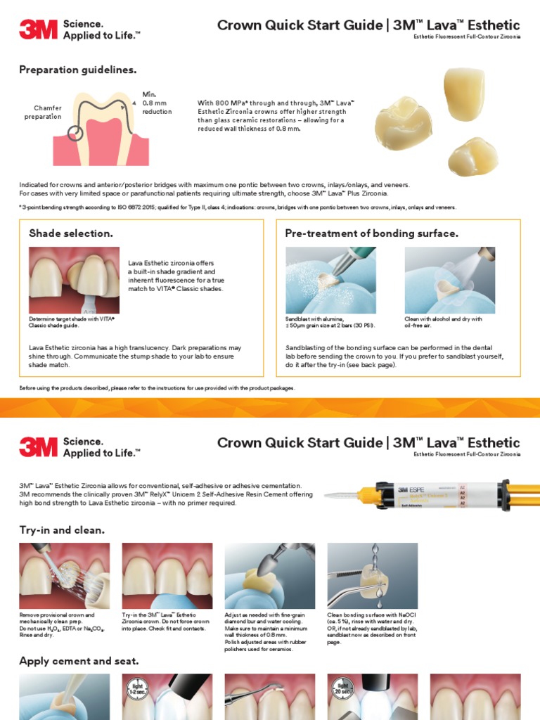 Crown Quick Start Guide - 3M Lava Esthetic: Preparation Guidelines ...
