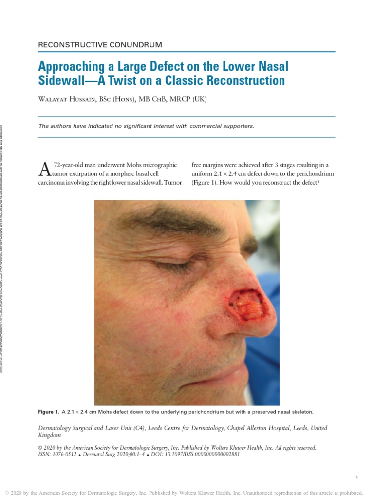 Approaching A Large Defect On The Lower Nasal.97652 | PDF | Human Nose ...