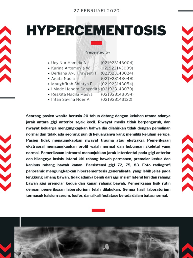 Hypercementosis | PDF | Sains & Matematika