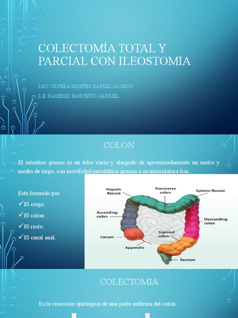 Anastomosis Intestinal Termino Terminal (Autoguardado) | PDF ...