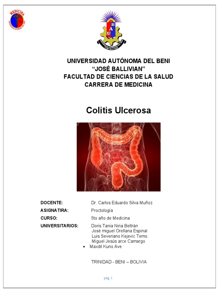 Colitis Ulcerosa. | PDF | Sistema inmune | Cáncer colonrectal