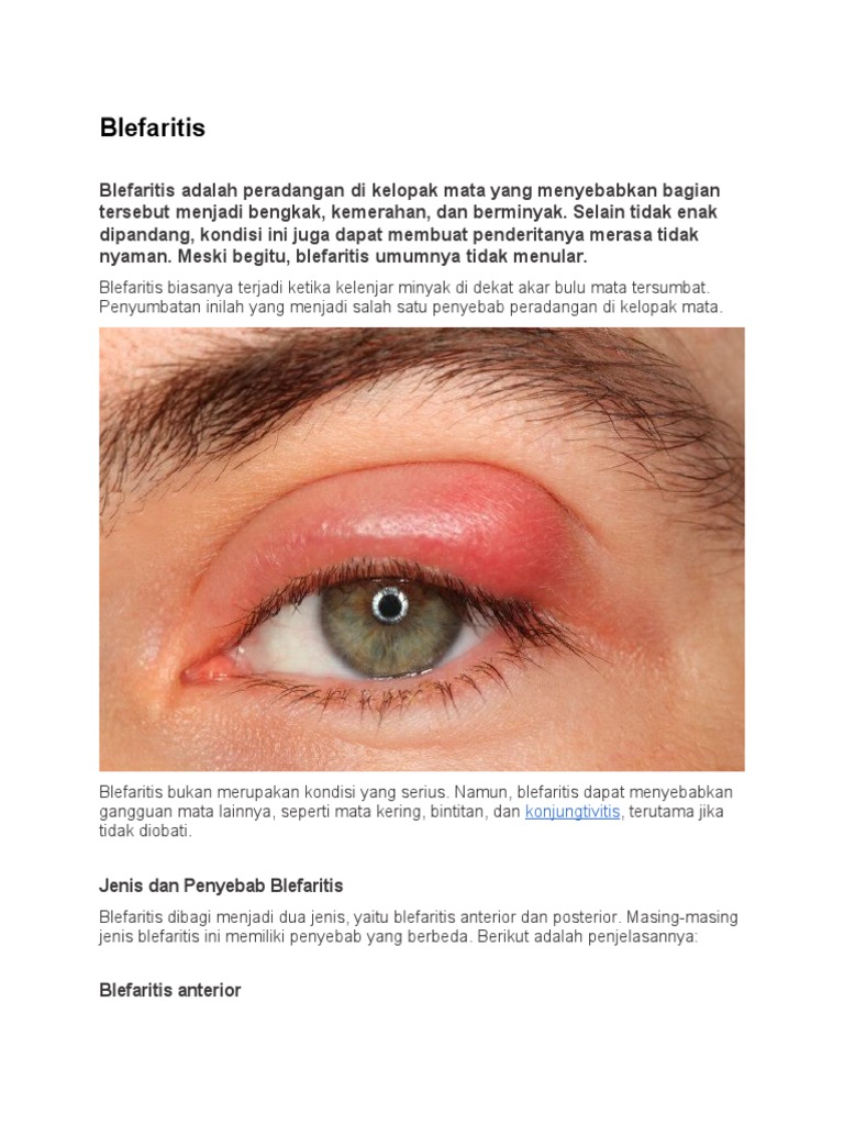 Blefaritis | PDF