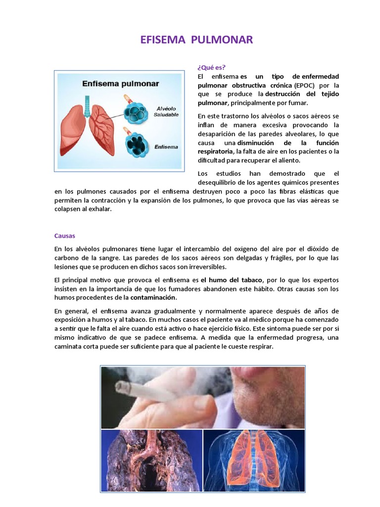Efisema Pulmonar | PDF | Enfermedad pulmonar obstructiva crónica | Alergia