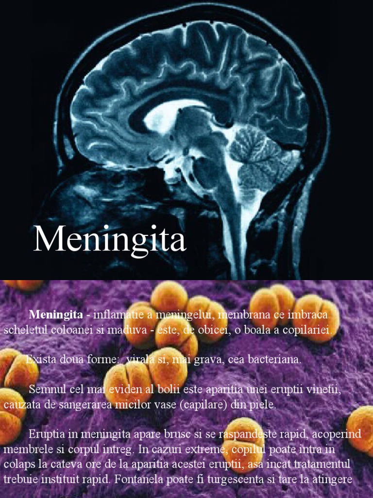 Meningita | PDF