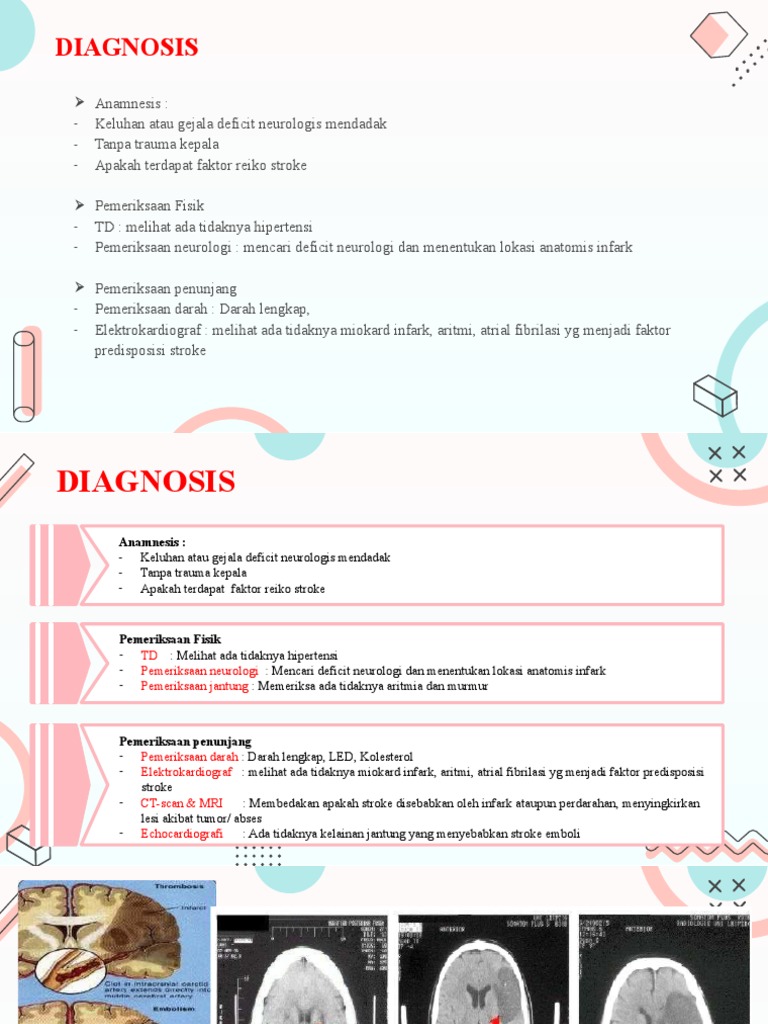 Diagnosis Stroke Iskemik | PDF | Sains & Matematika