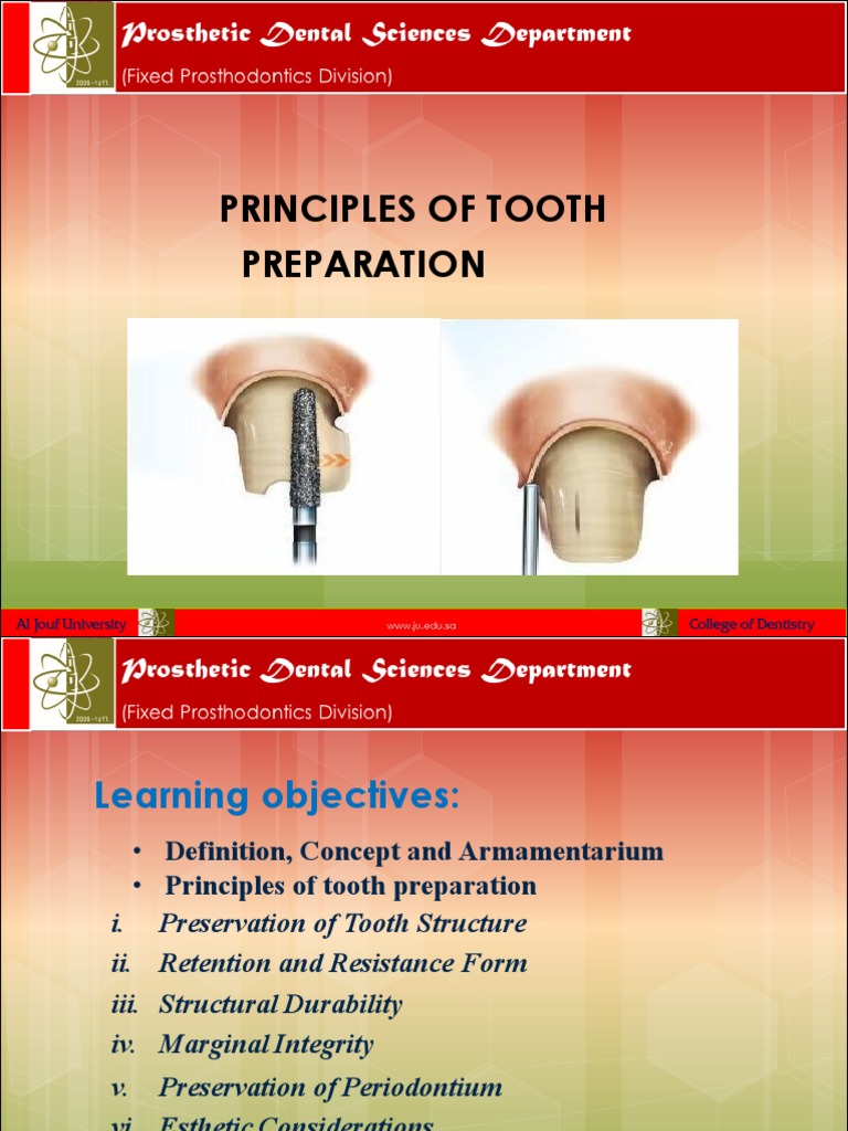 2-3. Principles of Tooth Preparation Part I & II DR Sghaireen | PDF ...
