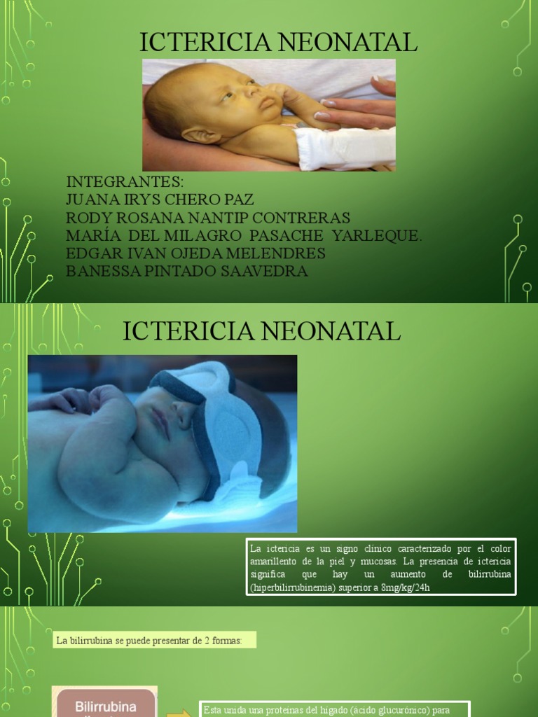 Ictericia Neonatal | Descargar gratis PDF | Medicina CLINICA | Enfermedades y trastornos