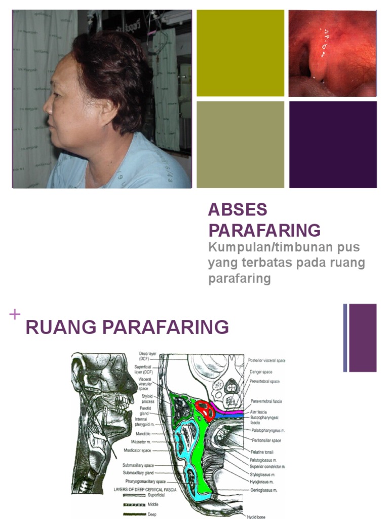 Abses Parafaring | PDF