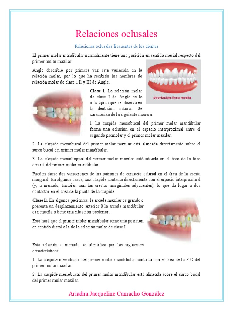 Relaciones Oclusales en Dentición Infantil | PDF | Ramas de Odontología ...