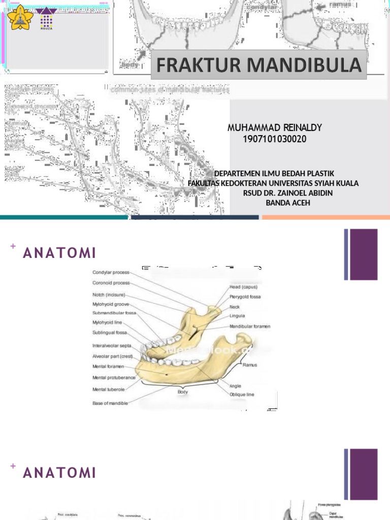 Bedah Plastik - Fraktur Mandibula | PDF