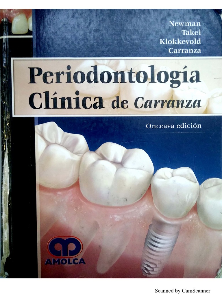 Unidad 2, Periodontologia Clínica Carranza 11 Ed Cap 65 | PDF