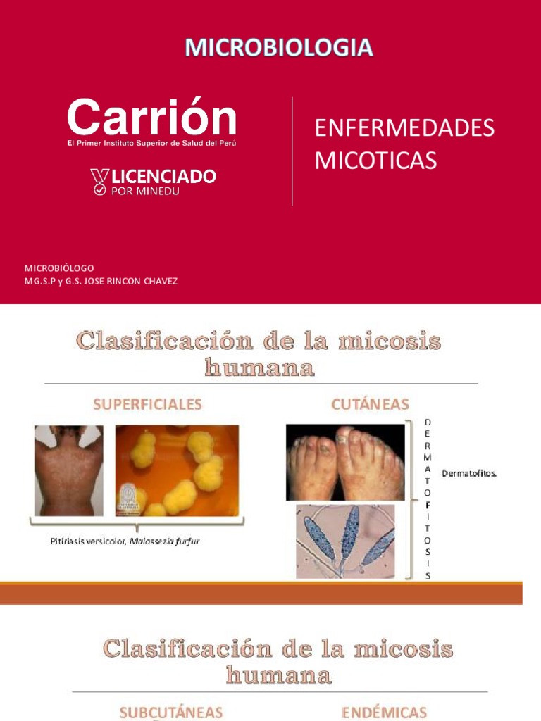 MICOSIS | PDF | Enfermedades y trastornos | Especialidades Medicas