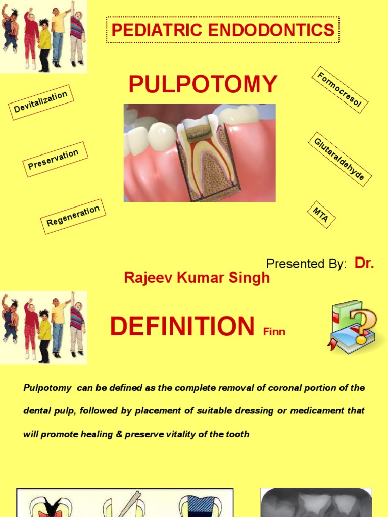 Pulpotomy: Pediatric Endodontics | PDF | Health Sciences | Clinical ...