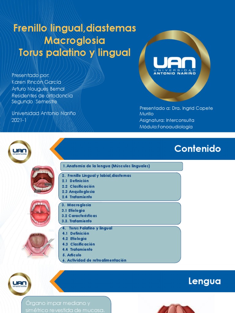 Seminario Frenillo Lingual - ÚltimaVersión | PDF | Anatomía humana | Boca