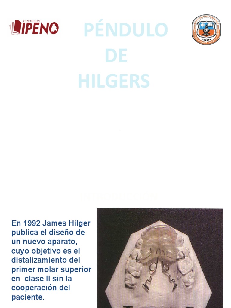 Péndulo de Hilgers en Ortodoncia | PDF