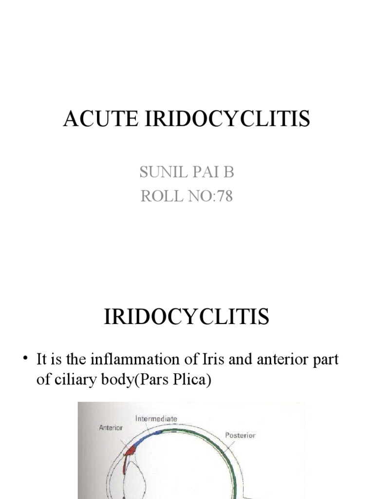 Acute Iridocyclitis: Sunil Pai B Roll No:78 | PDF | Clinical Medicine ...