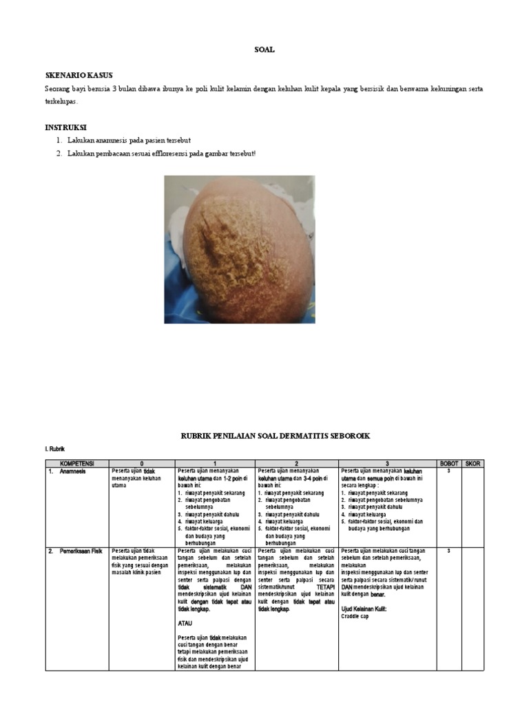 Soal Dermatitis Seboroik | PDF