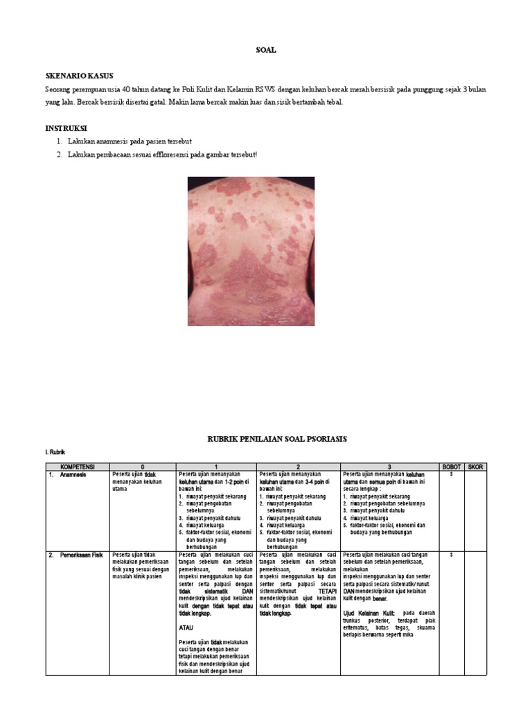 Soal Psoriasis | PDF