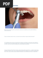 Extracción de Restos Radiculares | PDF | Boca | Odontología