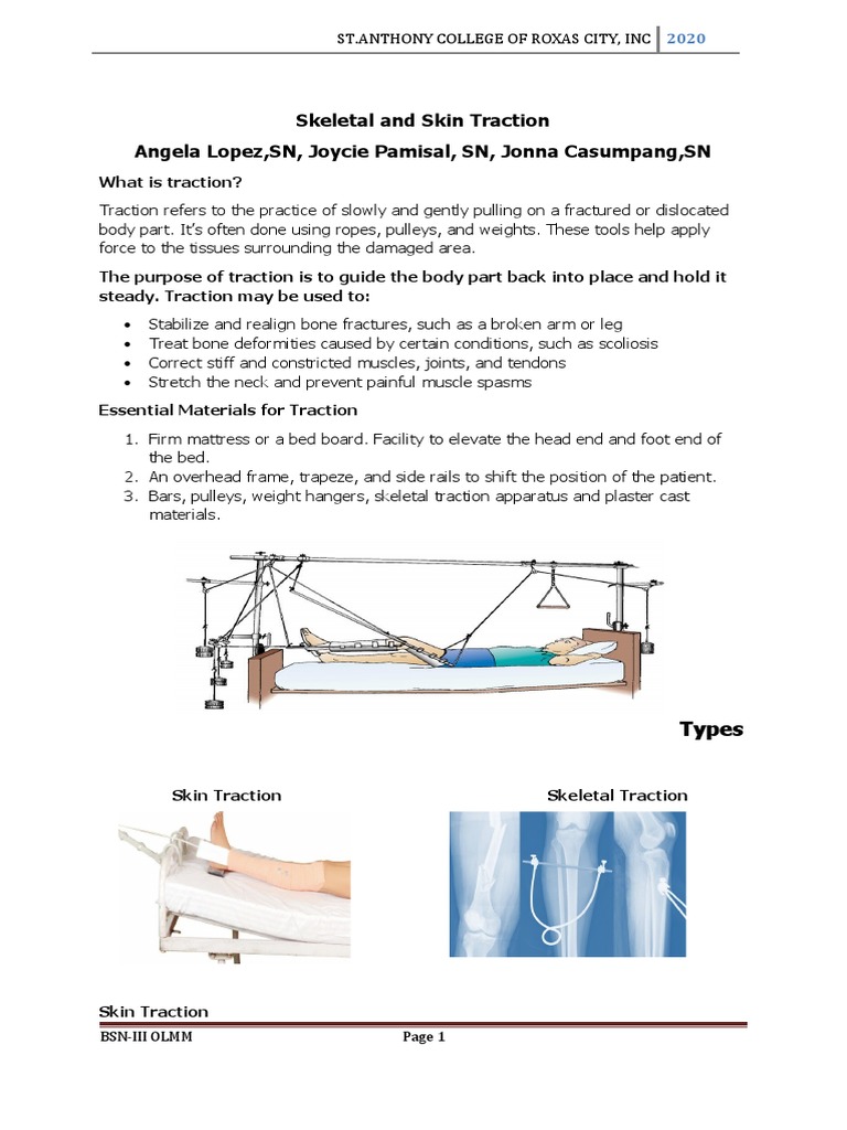 Skeletal and Skin Traction | PDF | Amputation | Prosthesis