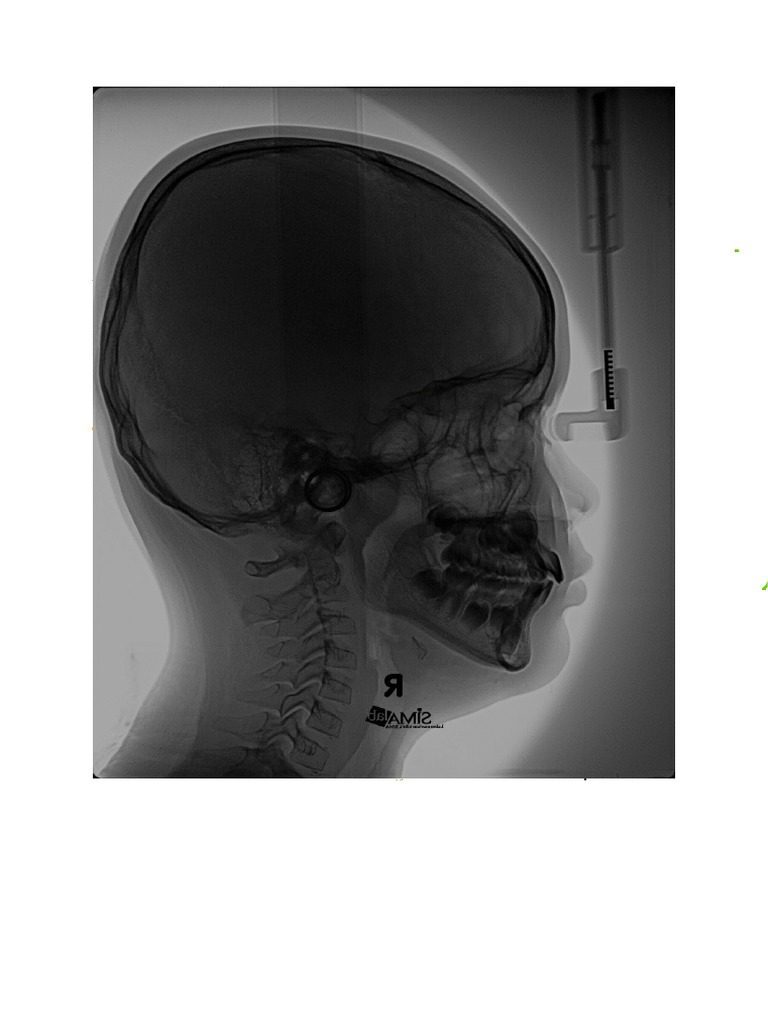 Tracing Sefalometri | PDF