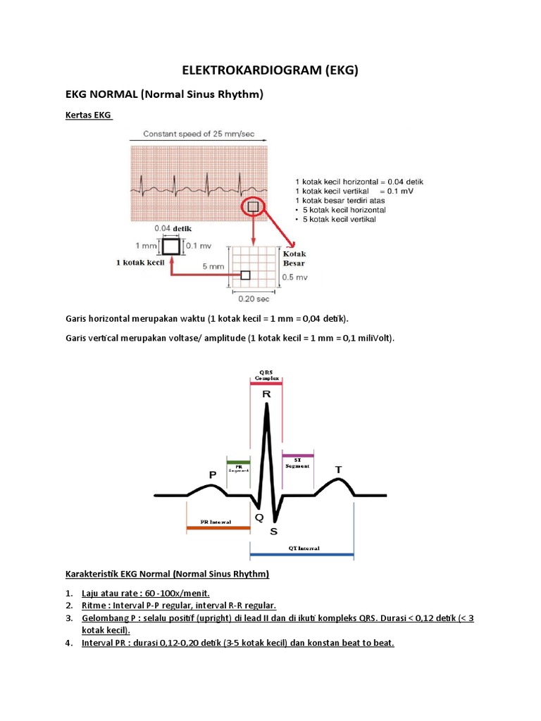 Elektrokardiogram (Ekg) : EKG NORMAL (Normal Sinus Rhythm) | PDF