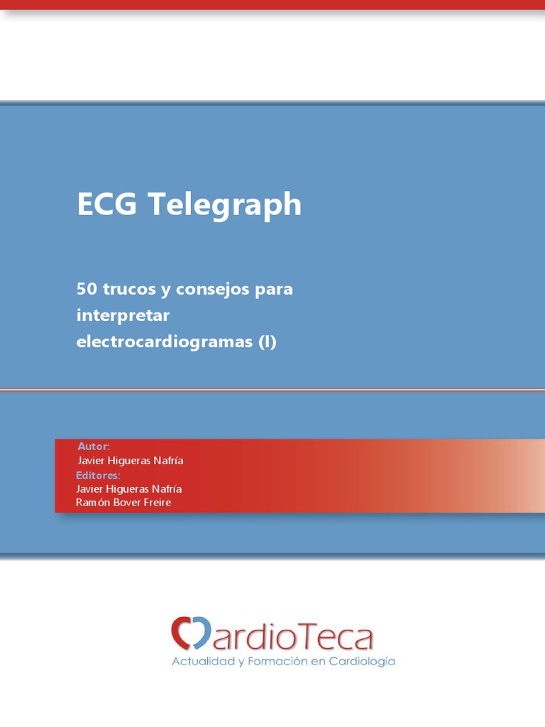 ECG Telegraph 50 Trucos Cardioteca I | PDF | Electrocardiografia ...