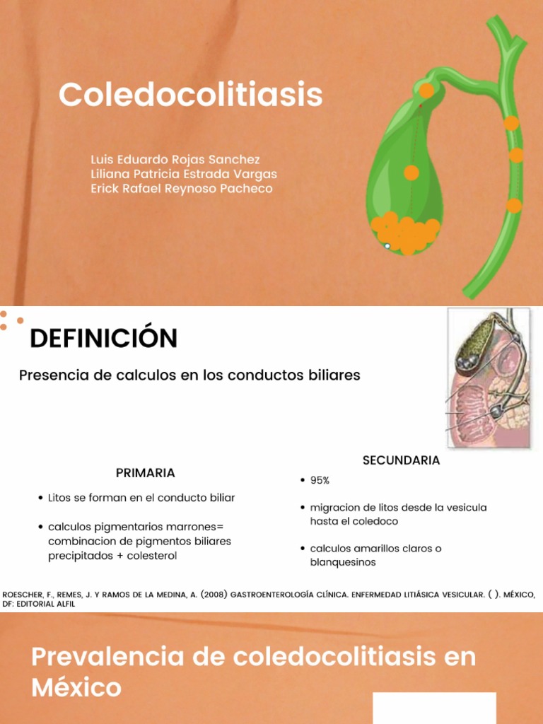 Coledocolitiasis | PDF