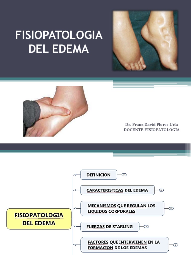 Fisiopatología - Edema | PDF | Edema | Especialidades Medicas