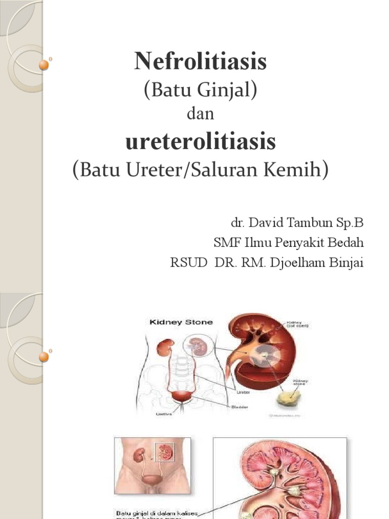 Nefrolitiasis & Ureterolitiasis | PDF | Sains & Matematika