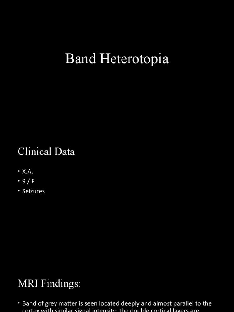 Band Heterotopia | PDF