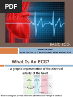 ECG Rhythm Analysis - Life in The Fast Lane ECG Library | PDF | Computers