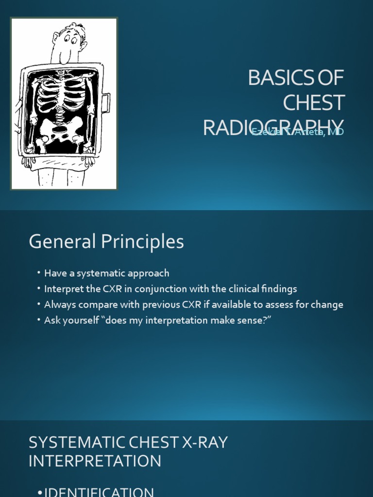 Basics of Chest Radiography | Download Free PDF | Lung | Anatomy
