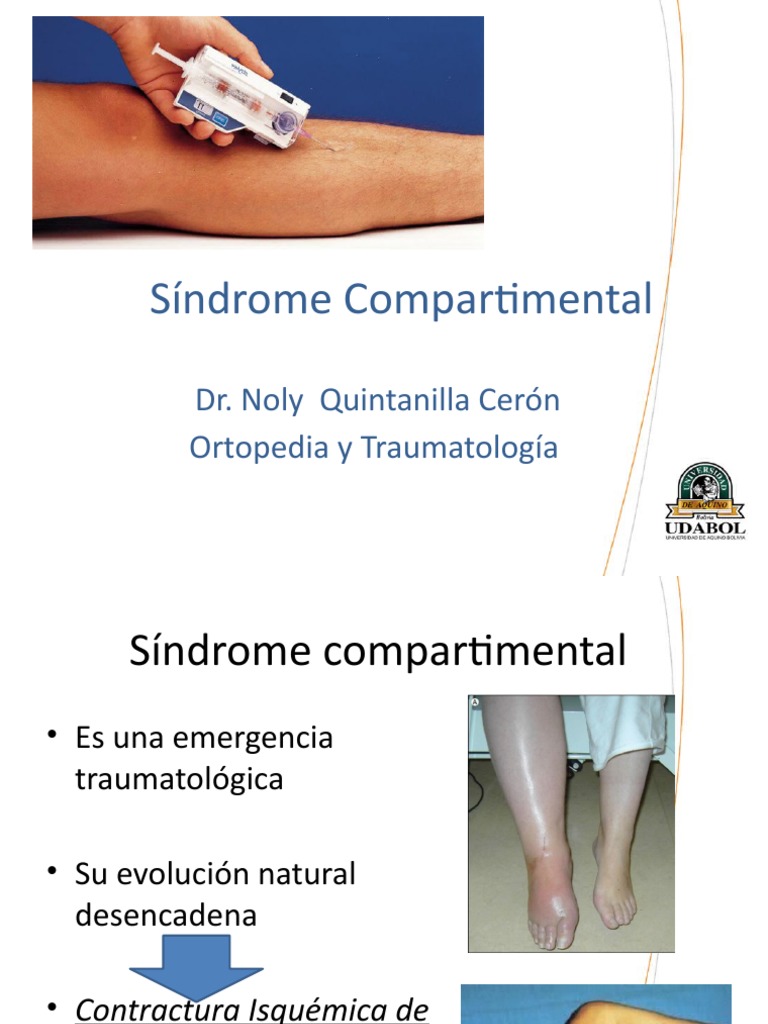 Síndrome Compartimental | PDF | Isquemia | Fisiología
