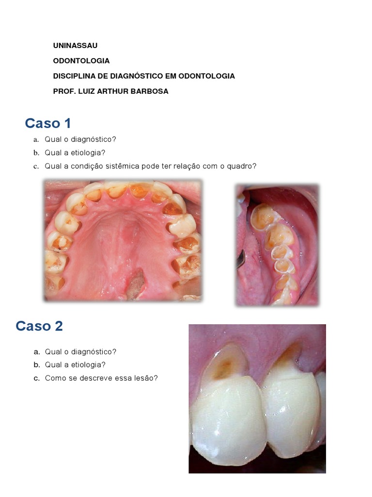 Casos para Revisão - Anomalias Do Desenvolvimento Orofacial, Dentária e ...