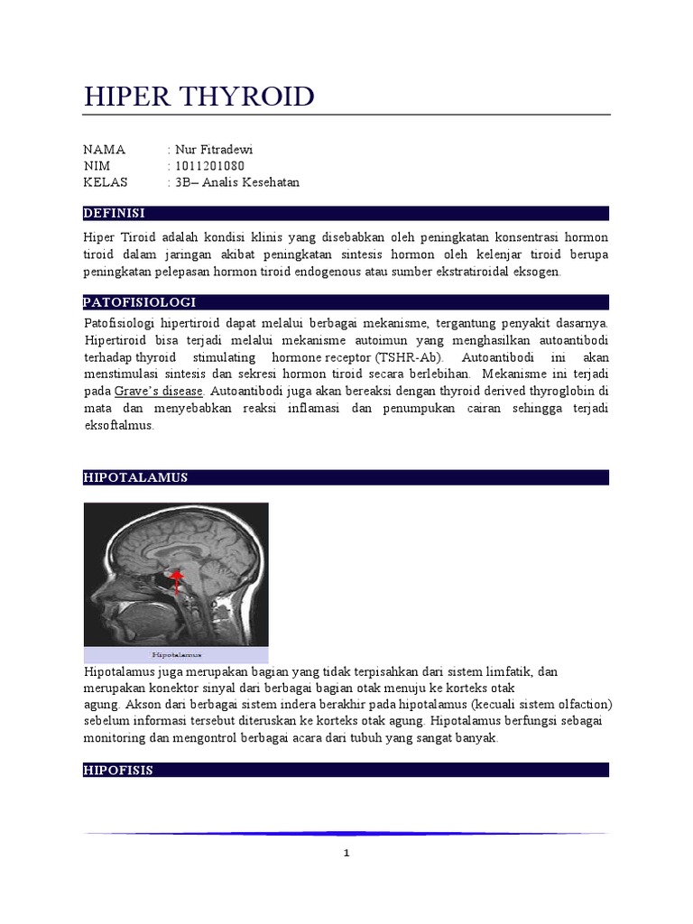 Hipertiroid | PDF | Kesehatan Holistik