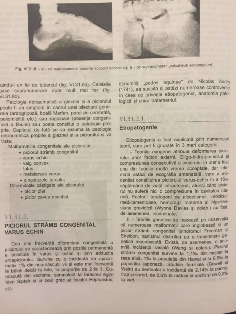 S50 Picior Stramb Cong Varus Equin Antonoescu | PDF