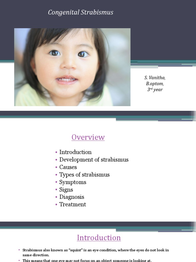Congenital Strabismus: S. Vanitha, B.optom, 3 Year | PDF | Light ...