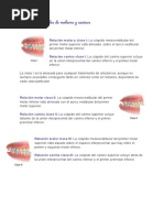 Relación Dental: Clases de Angle y Andrews | PDF | Anatomia dental | Diente