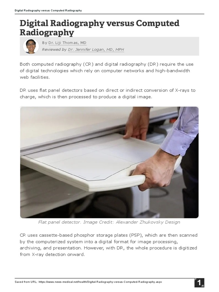 Digital Radiography Versus Computed Radiography: Reviewed by | PDF ...
