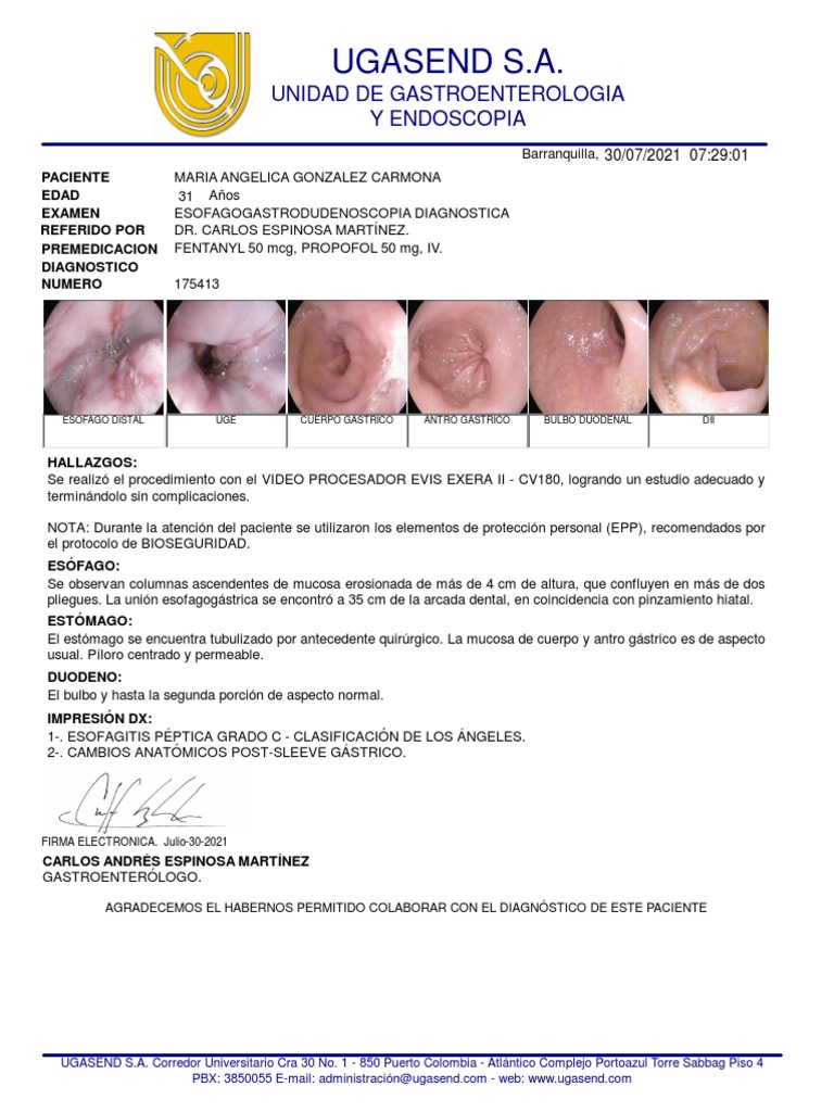 Diagnóstico de esofagitis péptica grado C y cambios anatómicos post ...
