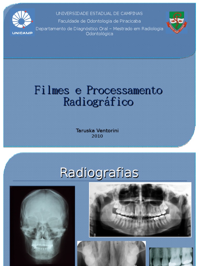 Seminário Filmes e Processamento Radiográfico | PDF | Radiologia | Ciências Físicas