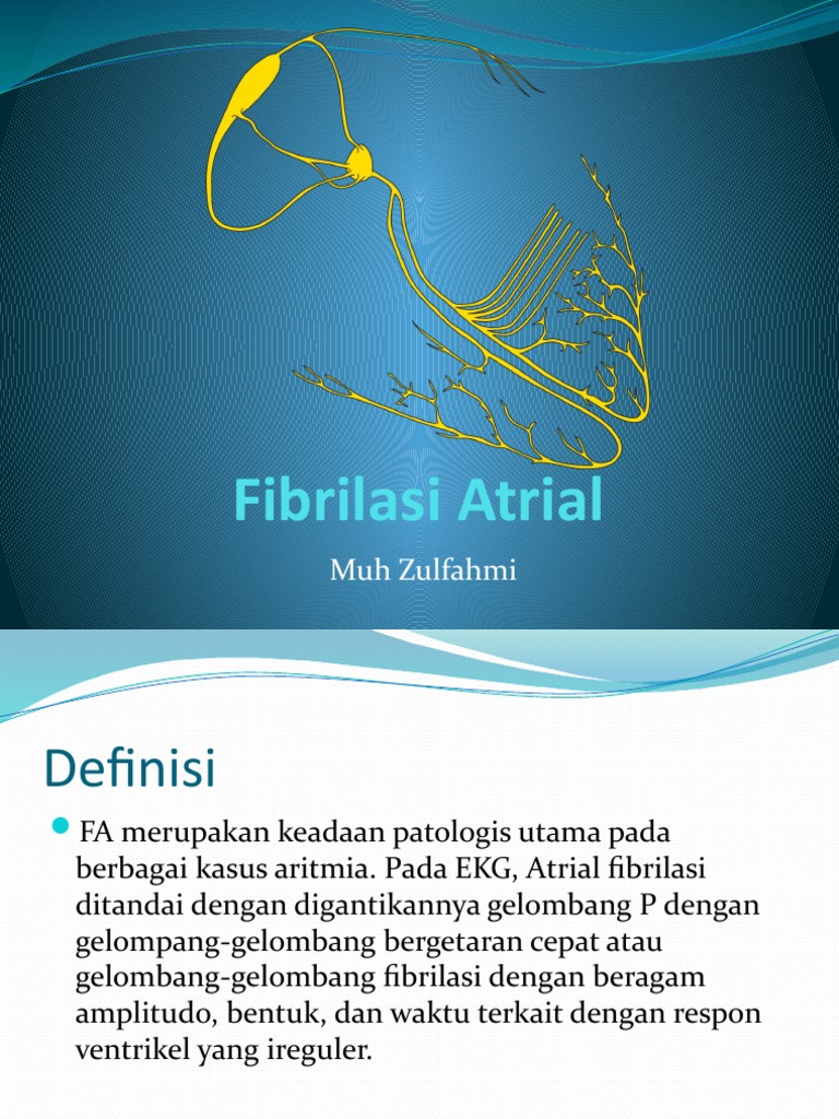 Fibrilasi Atrial | PDF