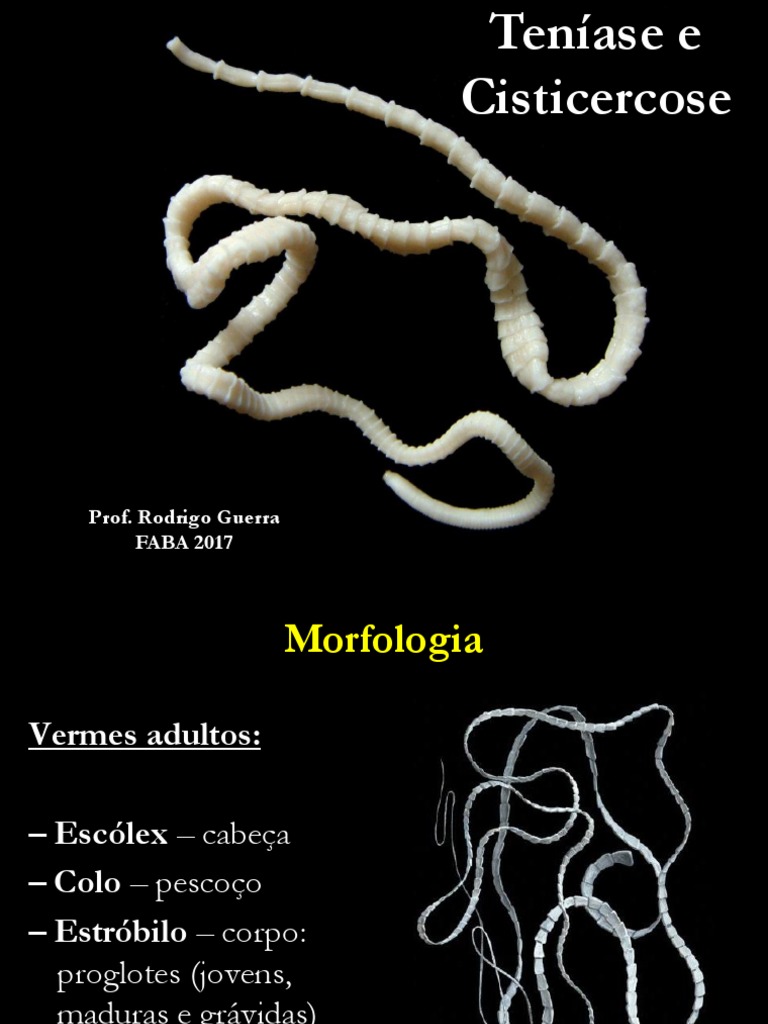 Teníase e Cisticercose: Morfologia e Sintomas | PDF | Medicina Clínica ...